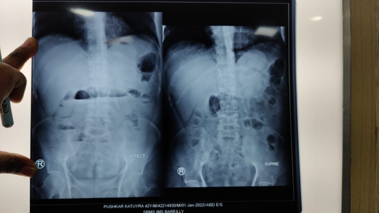 Pain abdomen - Medcase